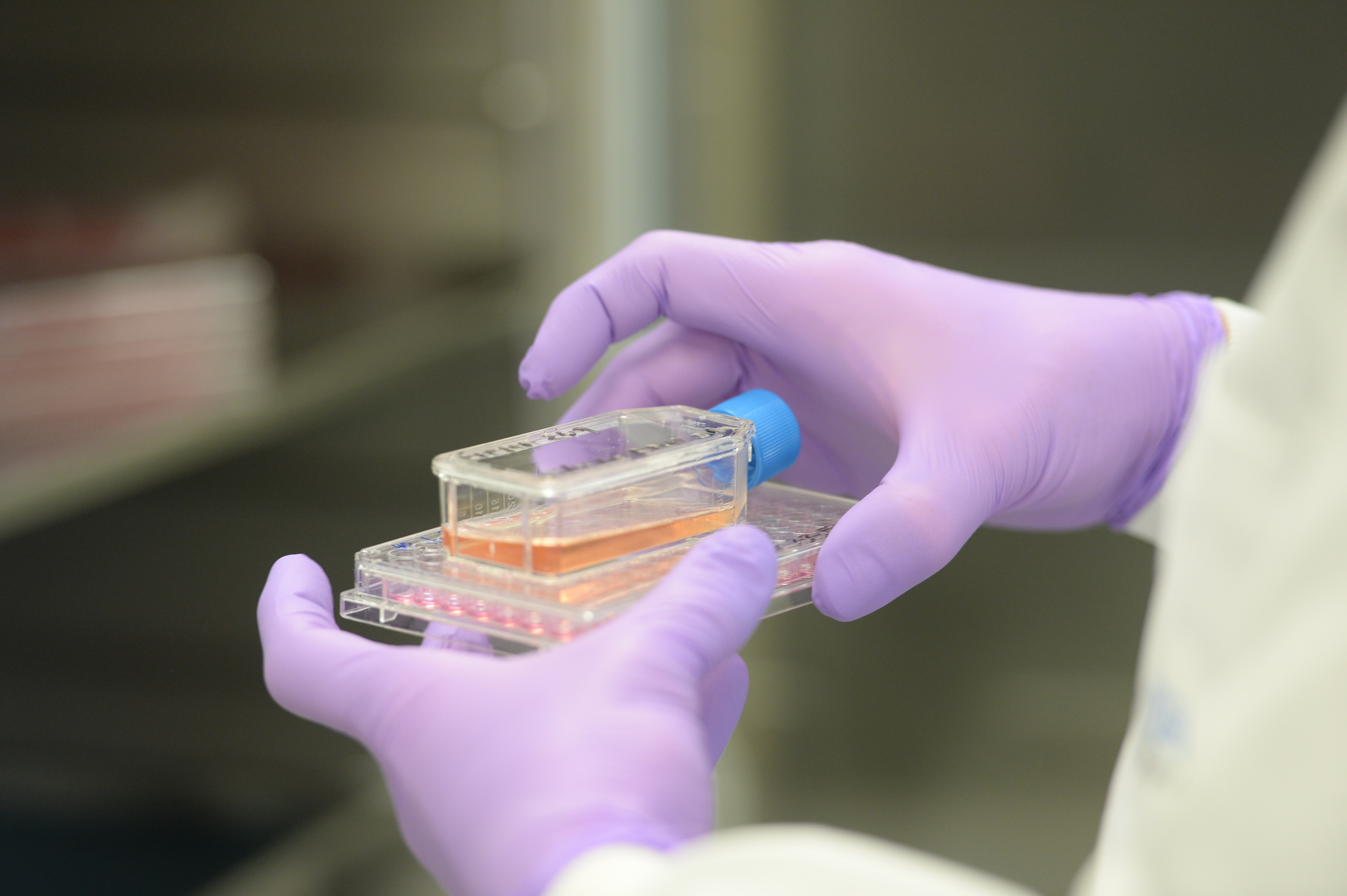 Cell Lines International Blood Group Reference Laboratory NHS Blood cell-lines-international-blood-group-reference-laboratory-nhs-blood