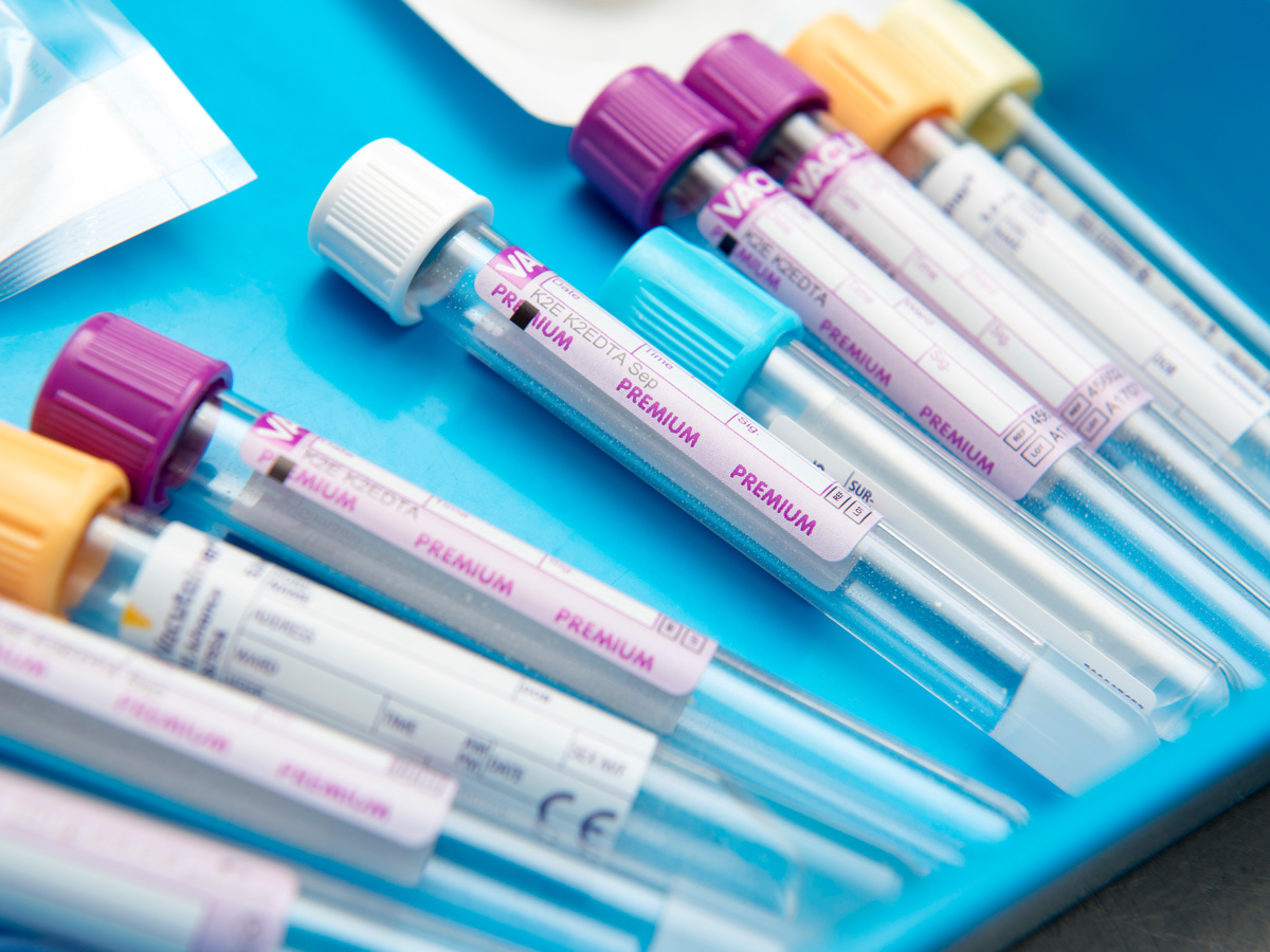 Blood samples used for coronavirus research - NHS Blood Donation