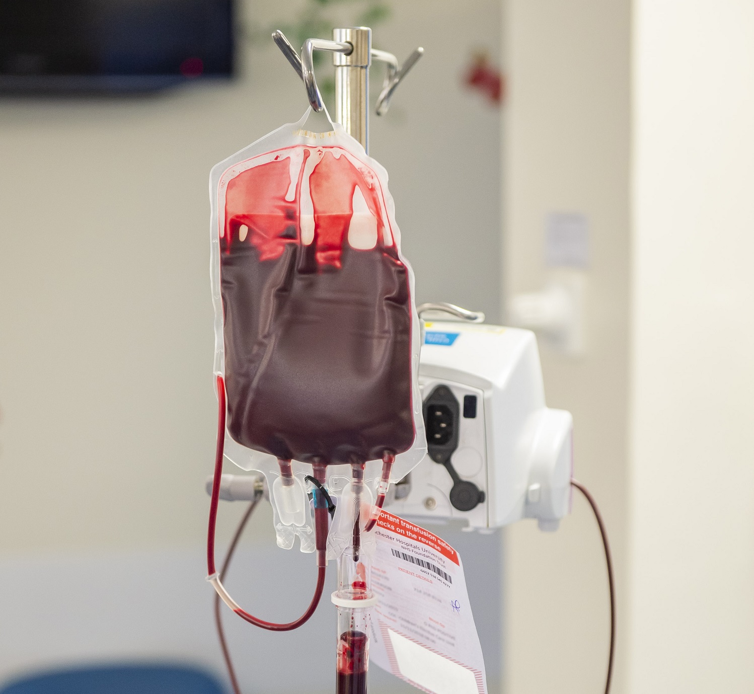 Data Driven Transfusion Practice - Research and Development - NHS Blood ...