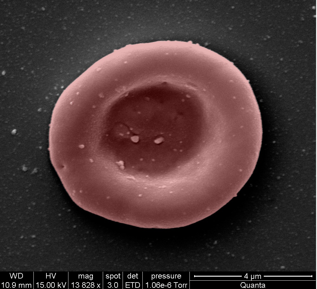 The NHSBT-led RESTORE trial into growing blood featured in The New ...