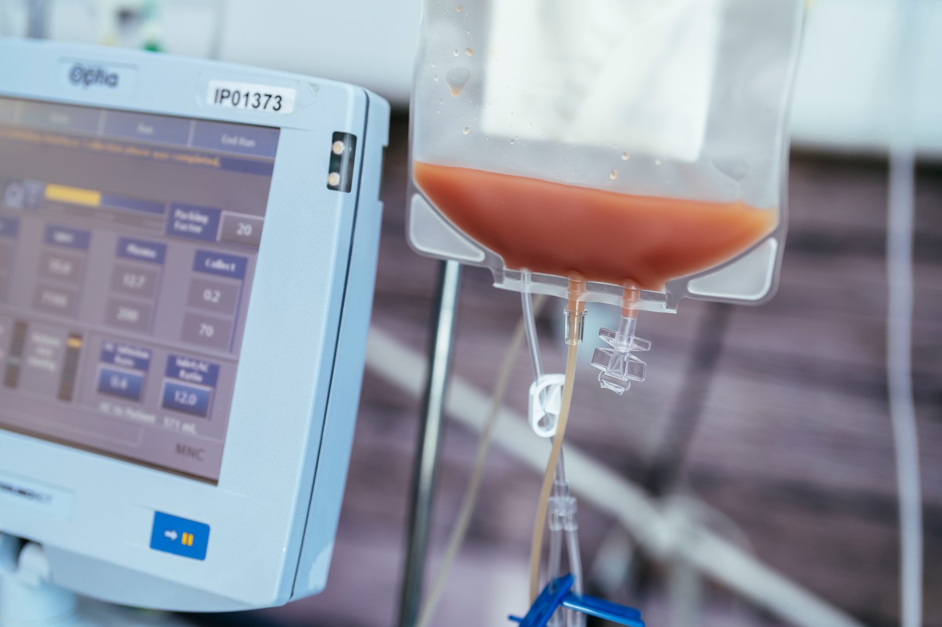 NHS Blood and Transplant research on transfusions for paediatric stem ...